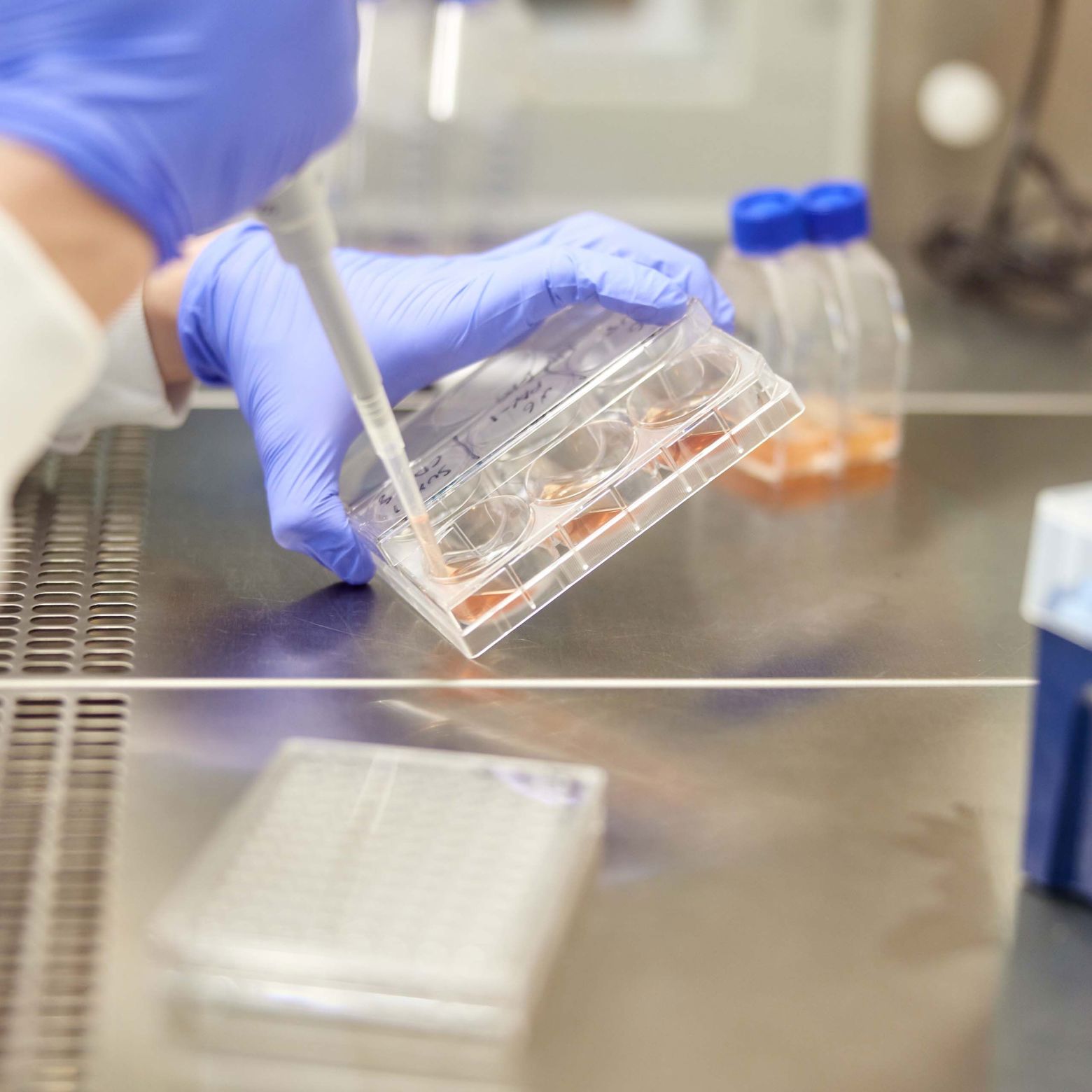 Pipeline products | Innovation | Autolus